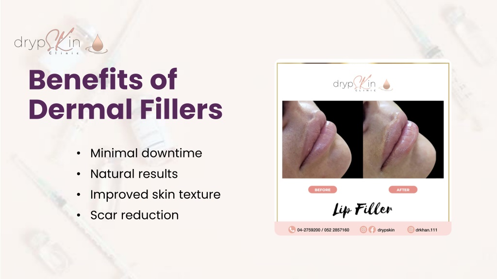 PPT - Dermal Fillers Dubai: Restoring Youthful Radiance PowerPoint ... PPT - Dermal Fillers Dubai: Restoring Youthful Radiance PowerPoint ...